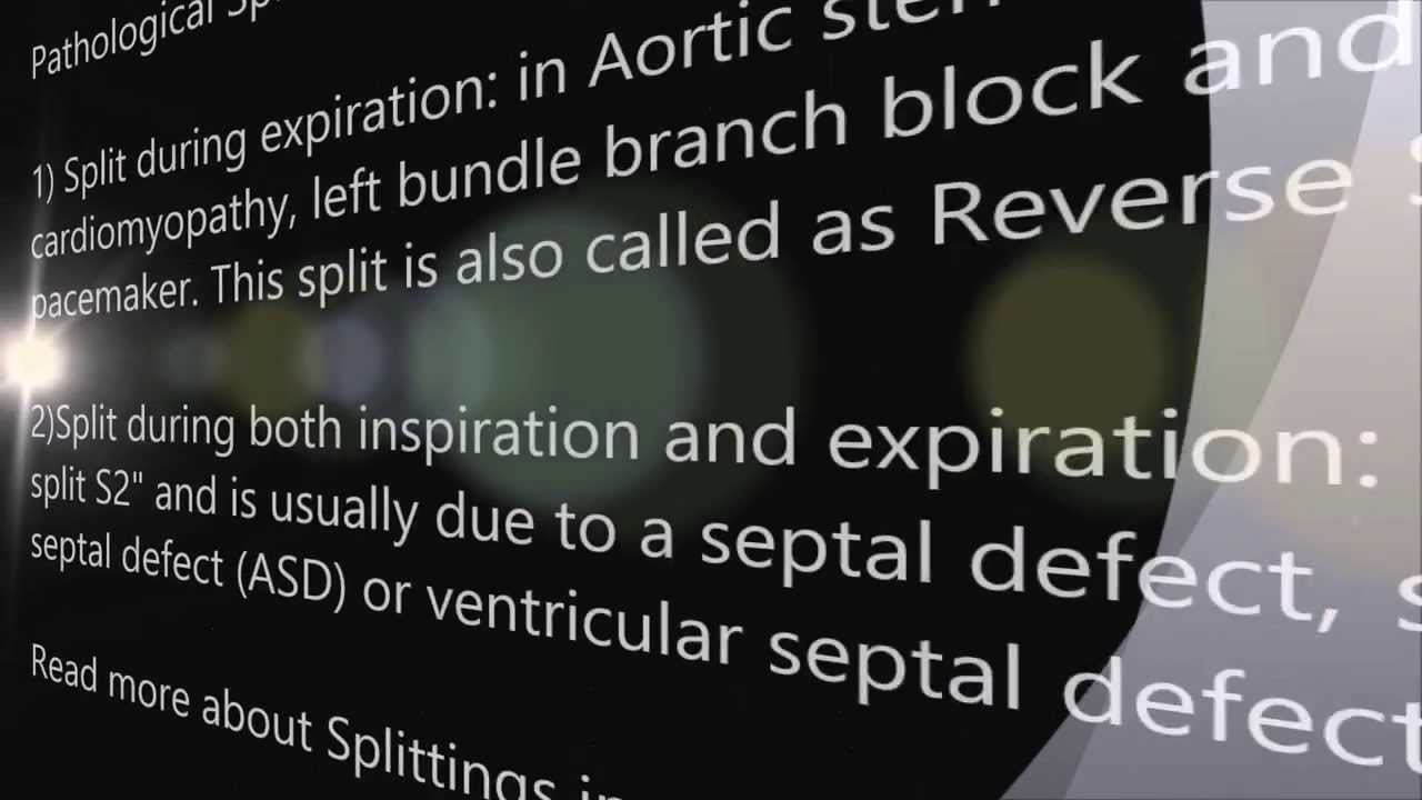 Audio Heart Sound of Split S2 (Split in 2nd Sound) : Real Time Cardiac ...