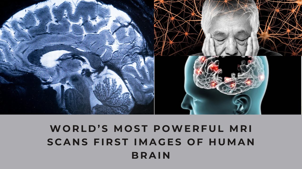 World’s Most Powerful MRI Scans First Images of Human Brain - YouTube