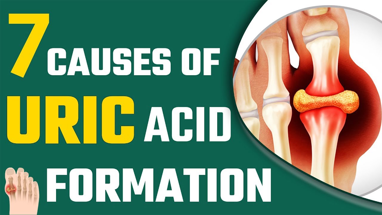 What is Uric Acid? Its 7 causes | Bharat Homeopathy - YouTube