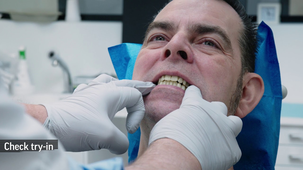 NextDent Workflow Copy Dentures - YouTube