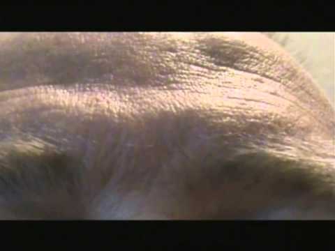 forehead twitching - YouTube