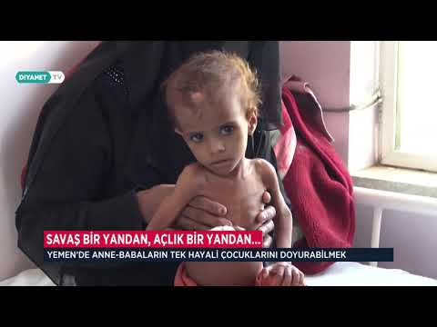 Yemen’de Anne-Babaların Tek Hayali Çocuklarını Doyurabilmek !