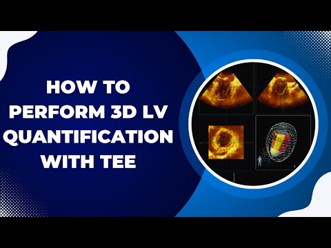 How to Perform 3D Left Ventricular Quantification with TEE (Transesophageal Echocardiography)
