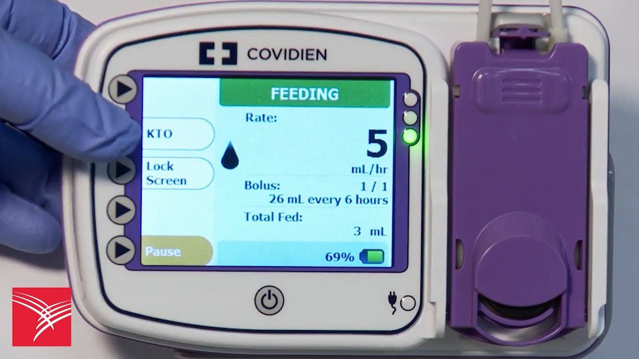 Adjusting the Keep Tube Open (KTO) Feature of the Kangaroo™ Connect ...