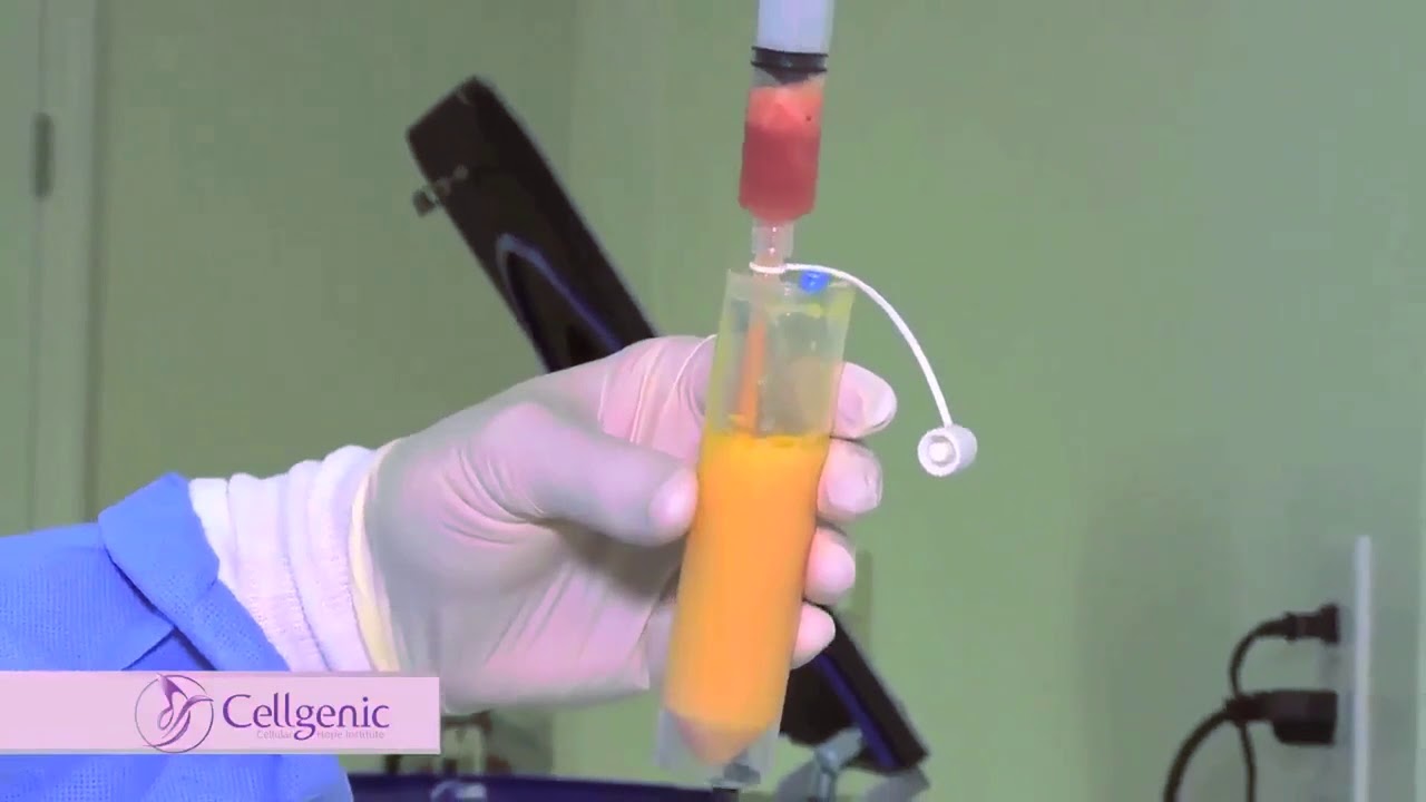 How is stem cell therapy with adipose tissue - YouTube