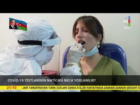COVID-19 testlərinin nəticəsi necə yoxlanılır?