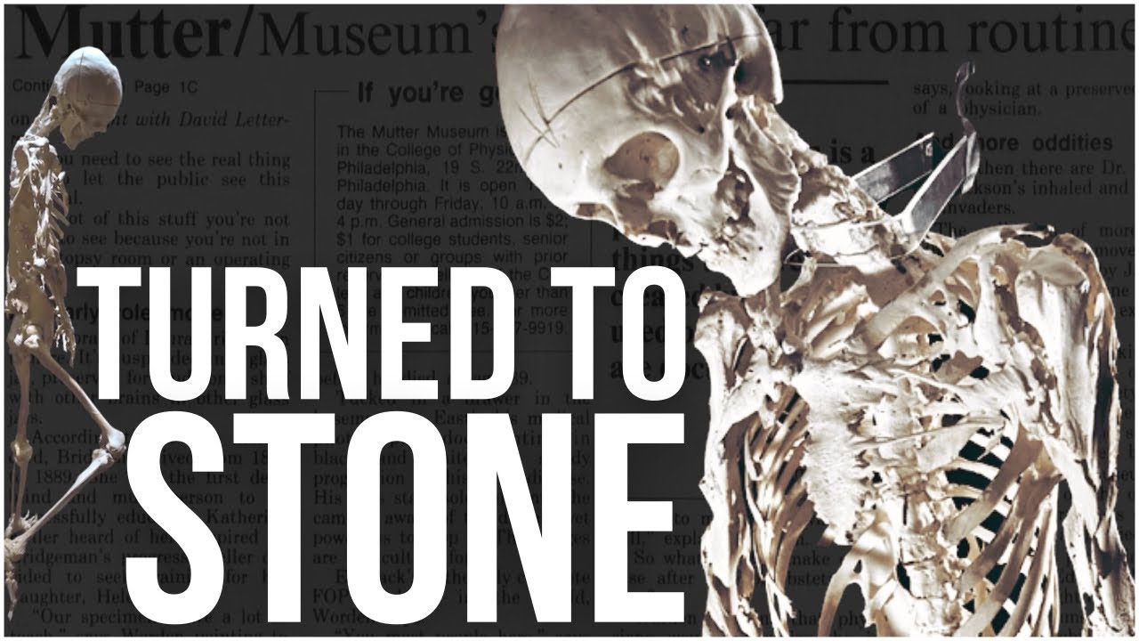 Stone Man Syndrome | The Man With a Second Skeleton (Disturbing ...