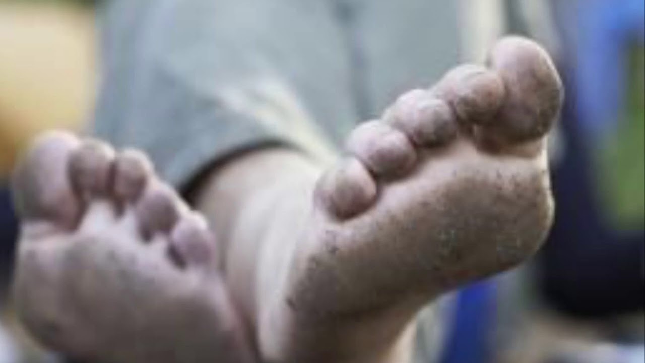 "Ten Toes Deep In Hope." A Sermon by Gerald Thomas, July 26, 2020 - YouTube