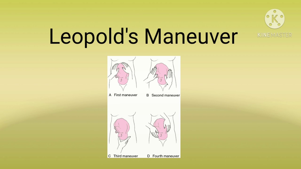 Fundal height measurement, Leopold's Maneuver and Ausculatation of ...