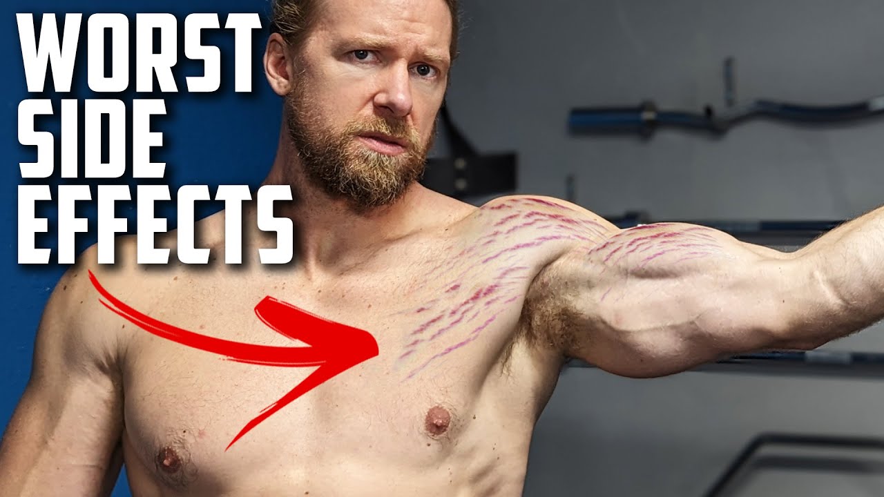 Worst Bodybuilding Side Effects NO ONE Wants To Talk About - Muscle Growth Worst Bodybuilding Side Effects NO ONE Wants To Talk About - Muscle Growth