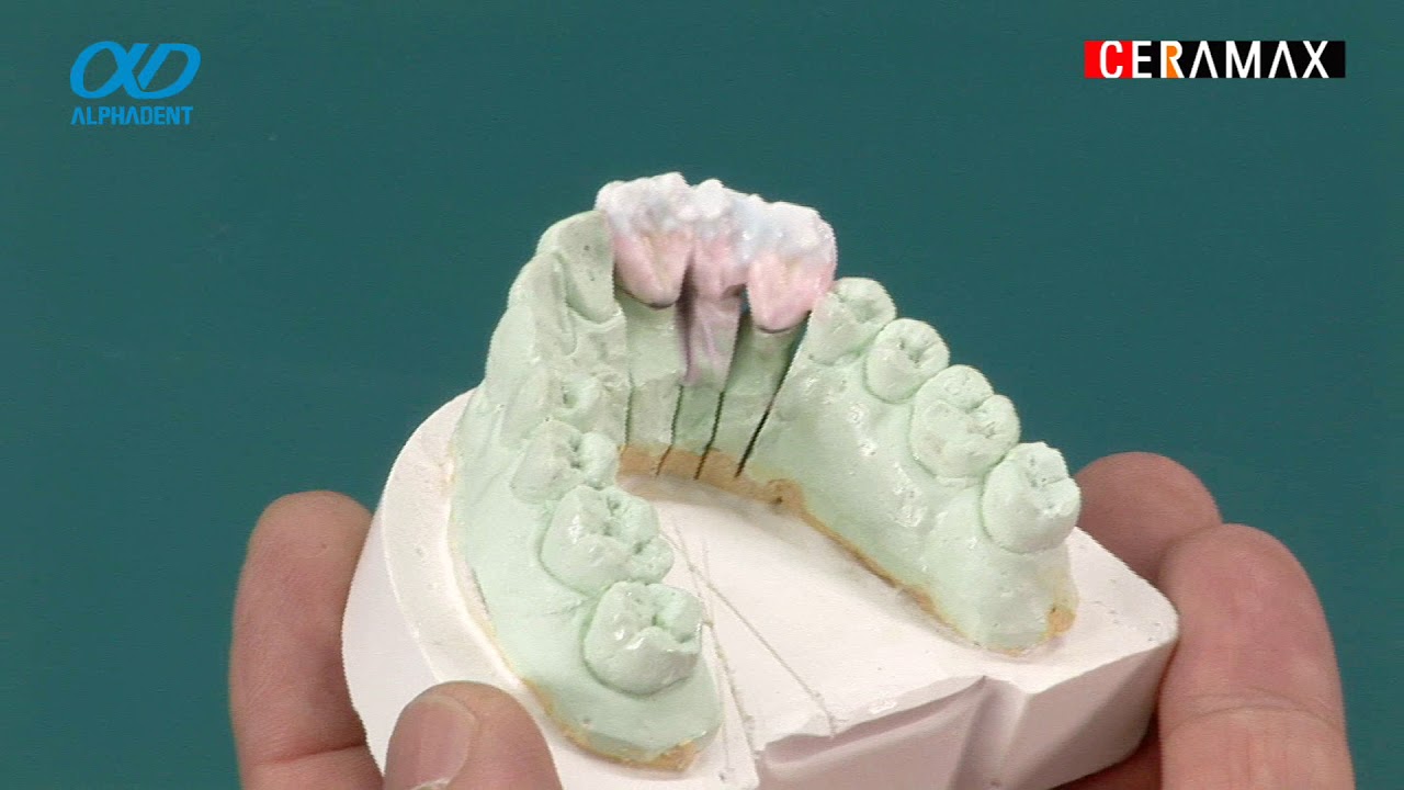 [HUDENS BIO] PORCELAIN : 'CERAMAX' USER'S MANUAL(ENG) - YouTube