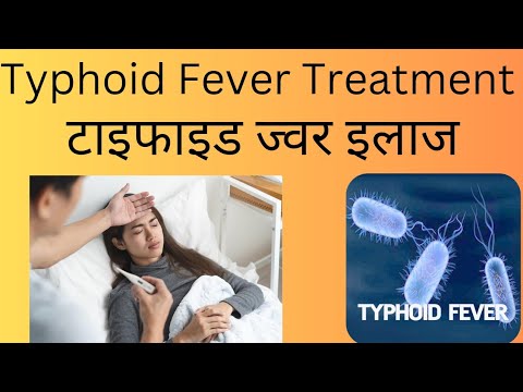 Fast-acting Solutions for Typhoid Fever Treatment | Typhoid Ko kaise ...