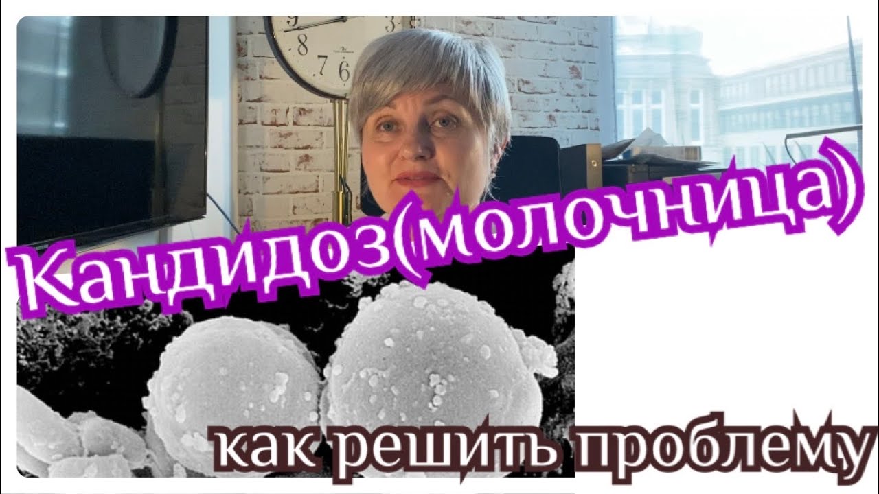 Кандидоз( молочница) ПРОСТОЕ СРЕДСТВО!! - YouTube