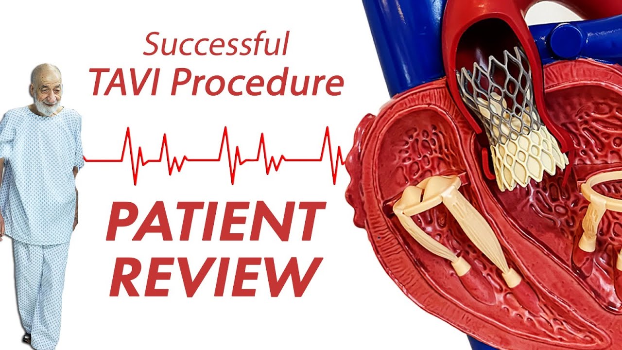 TAVI Procedure | Patient Review | Success Story | BTIH - YouTube
