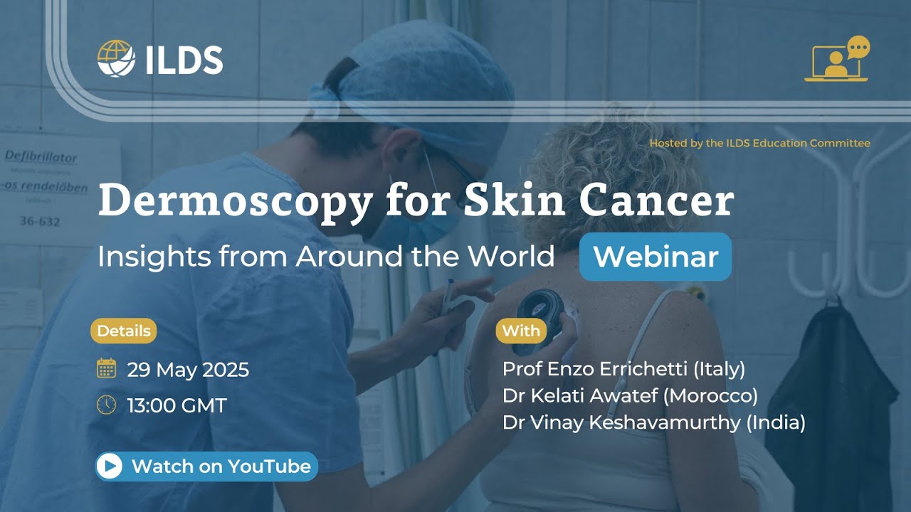 Dermoscopy for Skin Cancer: Insights from Around the World - YouTube