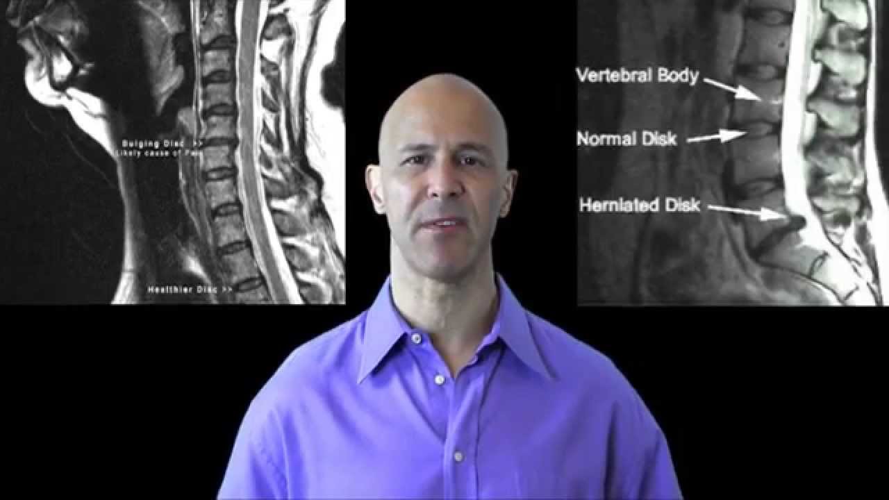 Drinking Water Reduces Neck Pain, Back Pain & Arthritis / Dr Mandell ...