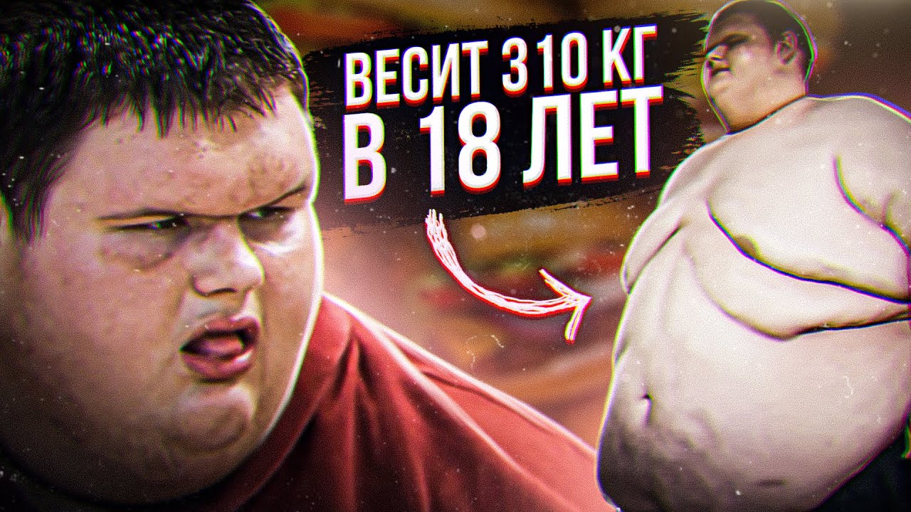 САМЫЙ ТОЛСТЫЙ ПОДРОСТОК в Америке. 310 КГ в 18 ЛЕТ! - YouTube