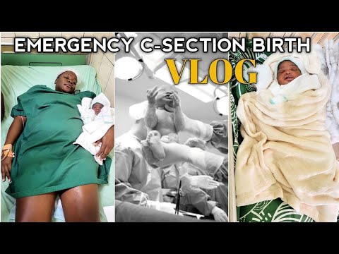 *Detailed *| MY EMERGENCY C-SECTION BIRTH VLOG | NO CONTRACTION ,NO ...