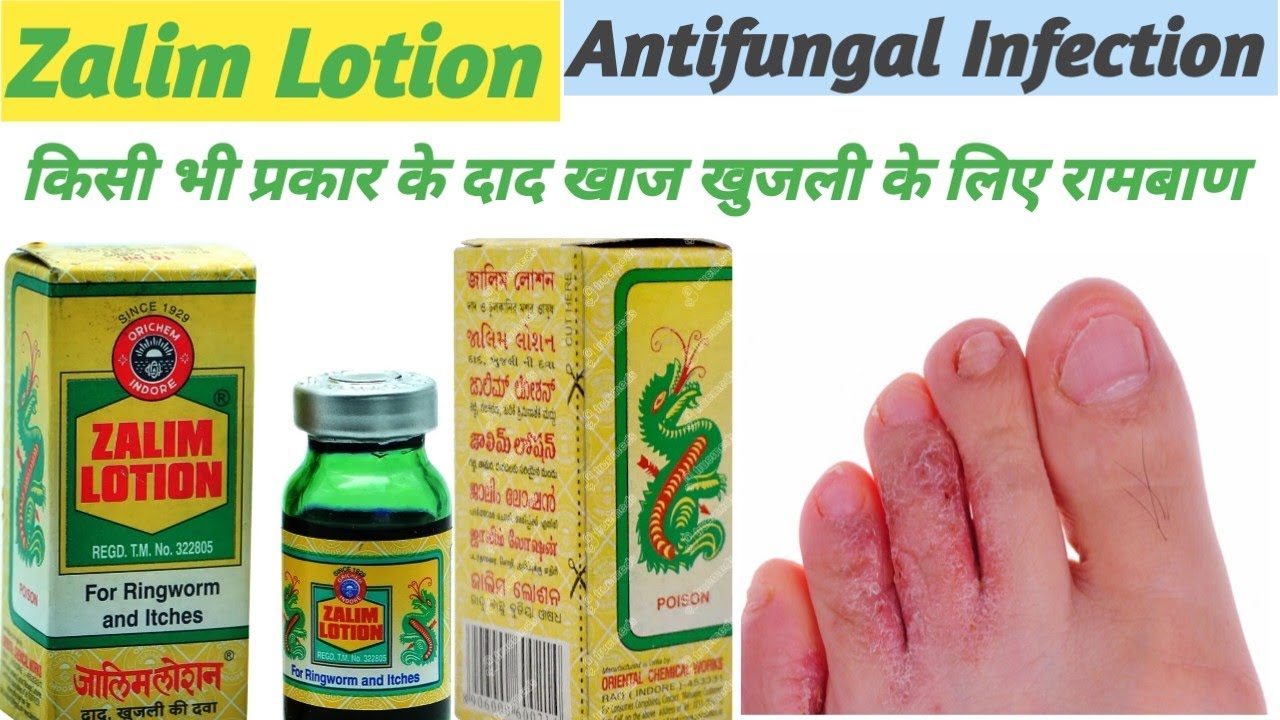Zalim Lotion!! दाद खाज खुजली के लिए रामबाण @Medicine uses support# ...