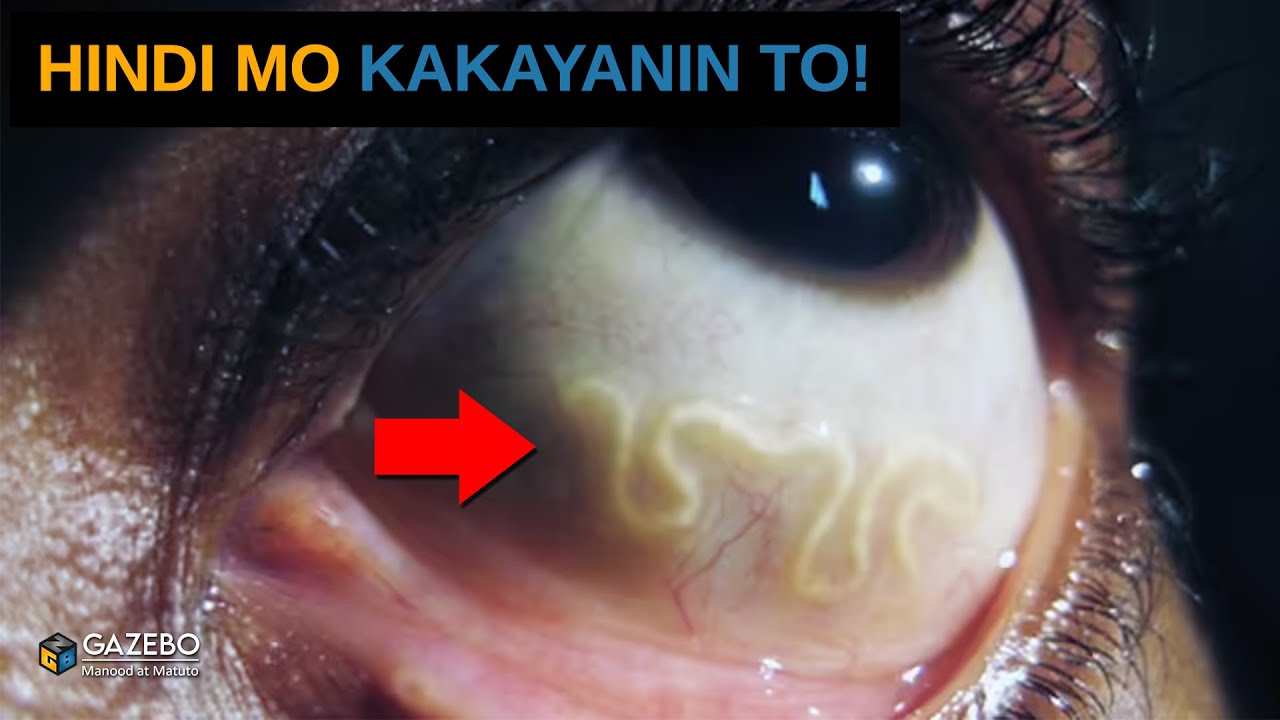 Mga Parasite na Kayang Pumasok at Mabuhay sa Loob ng Balat! - YouTube