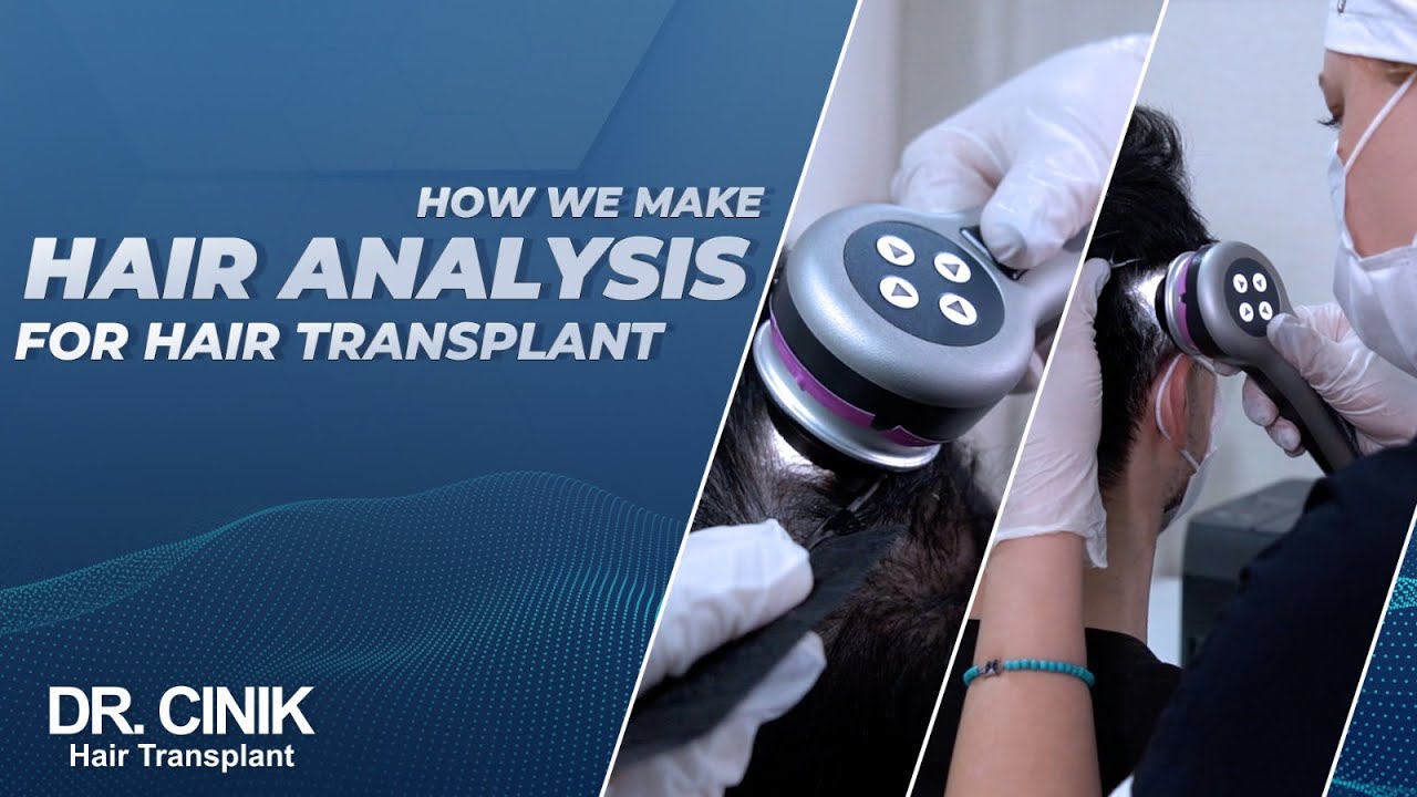 Dr.Cinik Hair Transplant Clinic - Hair Analysis for Hair Transplant ...