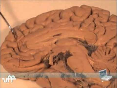 videoaulas uff br NEUROANATOMIA Face Medial do Hemif rio Cerebral Parte 2 Portal de aulas da xvid