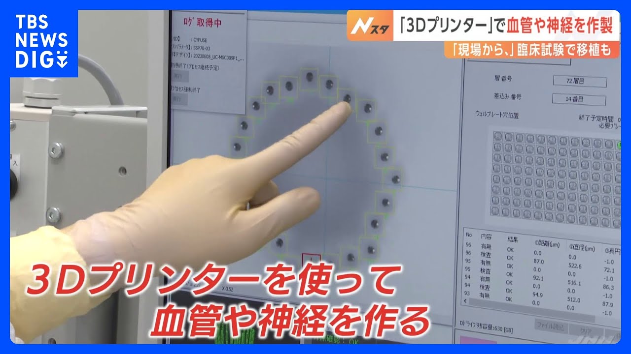 3Dプリンターで「血管」「神経」を作製！？臨床試験で移植も実施…“夢の治療法”に迫る｜TBS NEWS DIG - YouTube