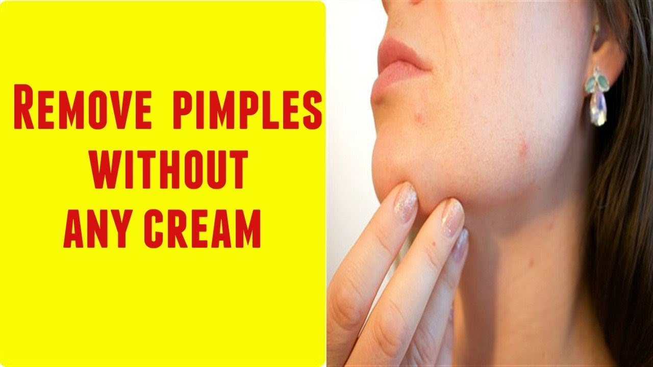 How To Remove Pimples Wthout Any Cream - YouTube