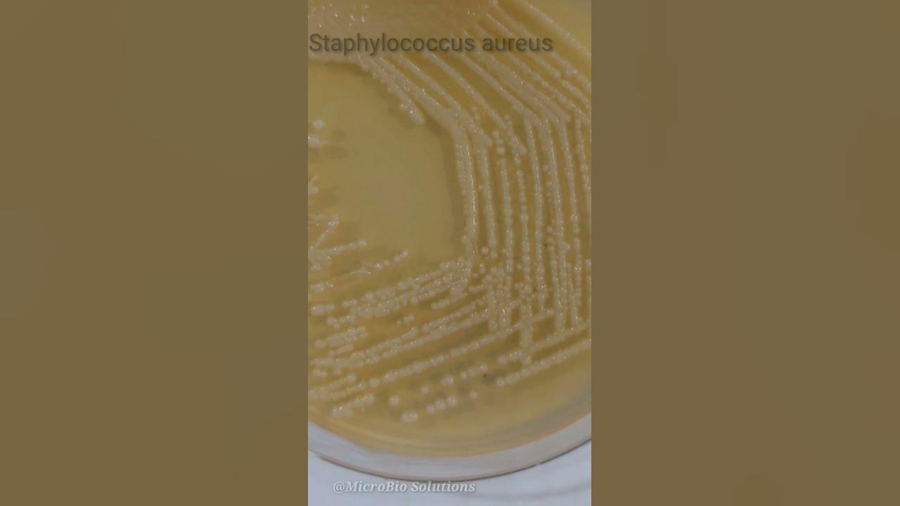 Staphylococcus aureus in Nutrient Agar - YouTube