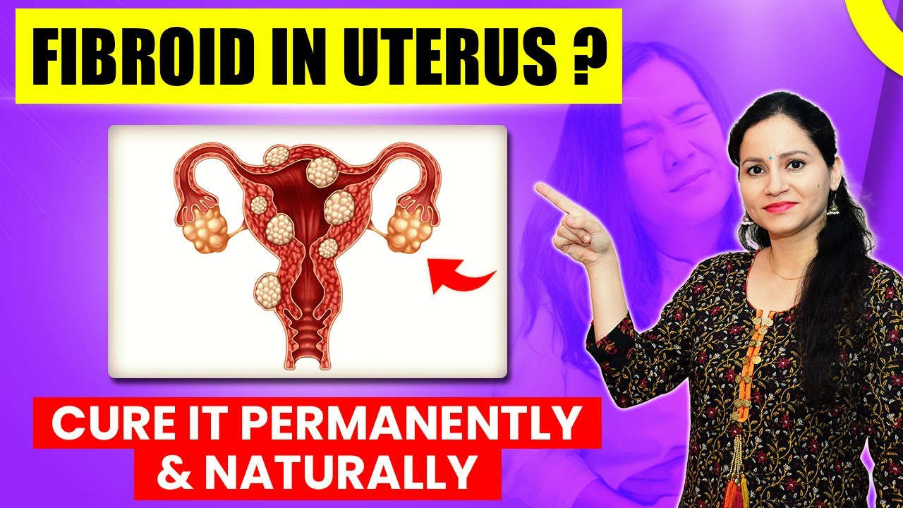 Fibroid Ayurvedic Treatment | Treatment for Uterine Fibroid | Best ...