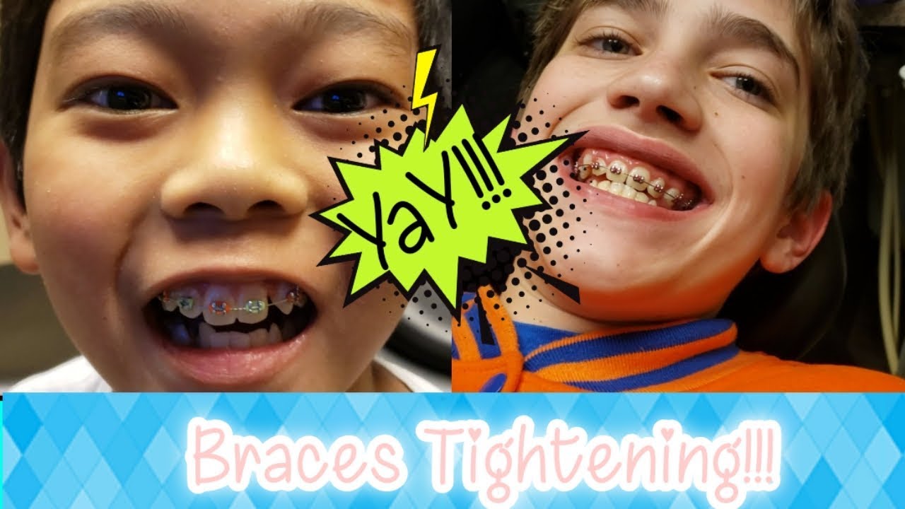 BokiSaur & Ryan's First Monthly Braces Checkup | Braces Tightening ...