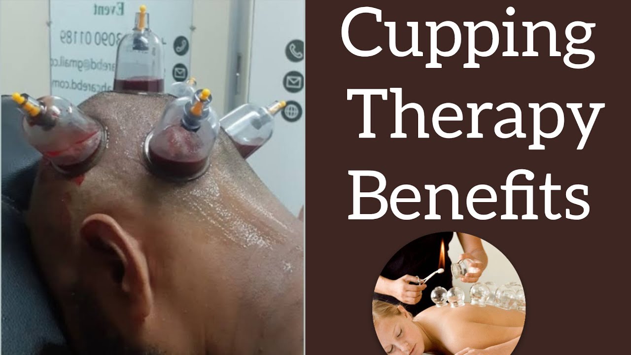 Cupping Therapy Benefits Cure To Every Disease Wet Cupping Therapy Youtube