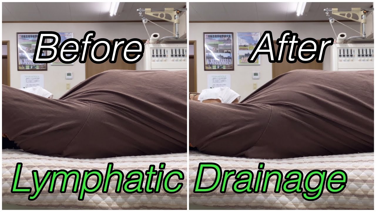 Cellulite and lymphatic drainage for stiff shoulder - YouTube