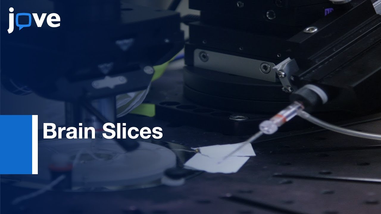 Image-guided Patch Clamp to Study Neurons in Brain Slices | Protocol ...