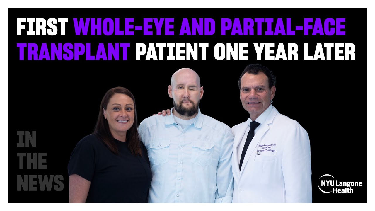 One Year Later: First Whole-Eye and Partial-Face Transplant Patient ...