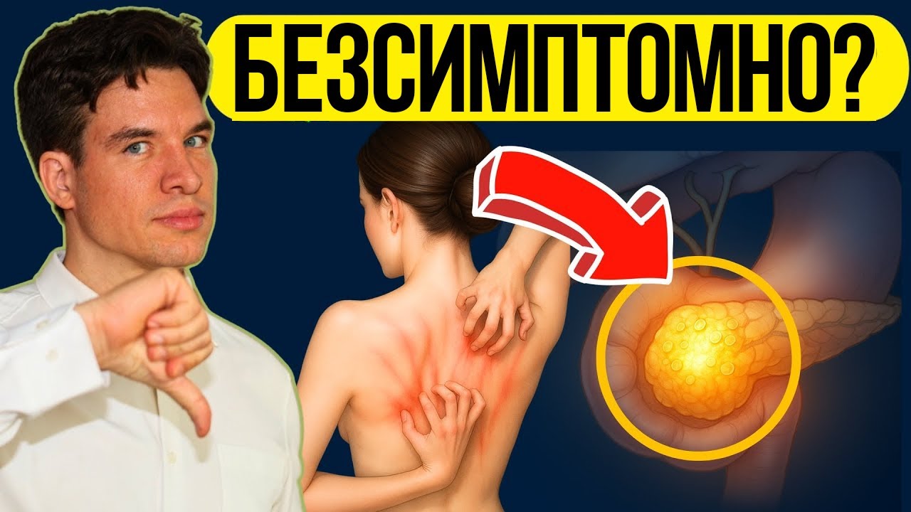 Самый Бесшумный Рак В Мире АТАКУЕТ Молодёжь — 7 Ранних Признаков Рака Поджелудочной Железы