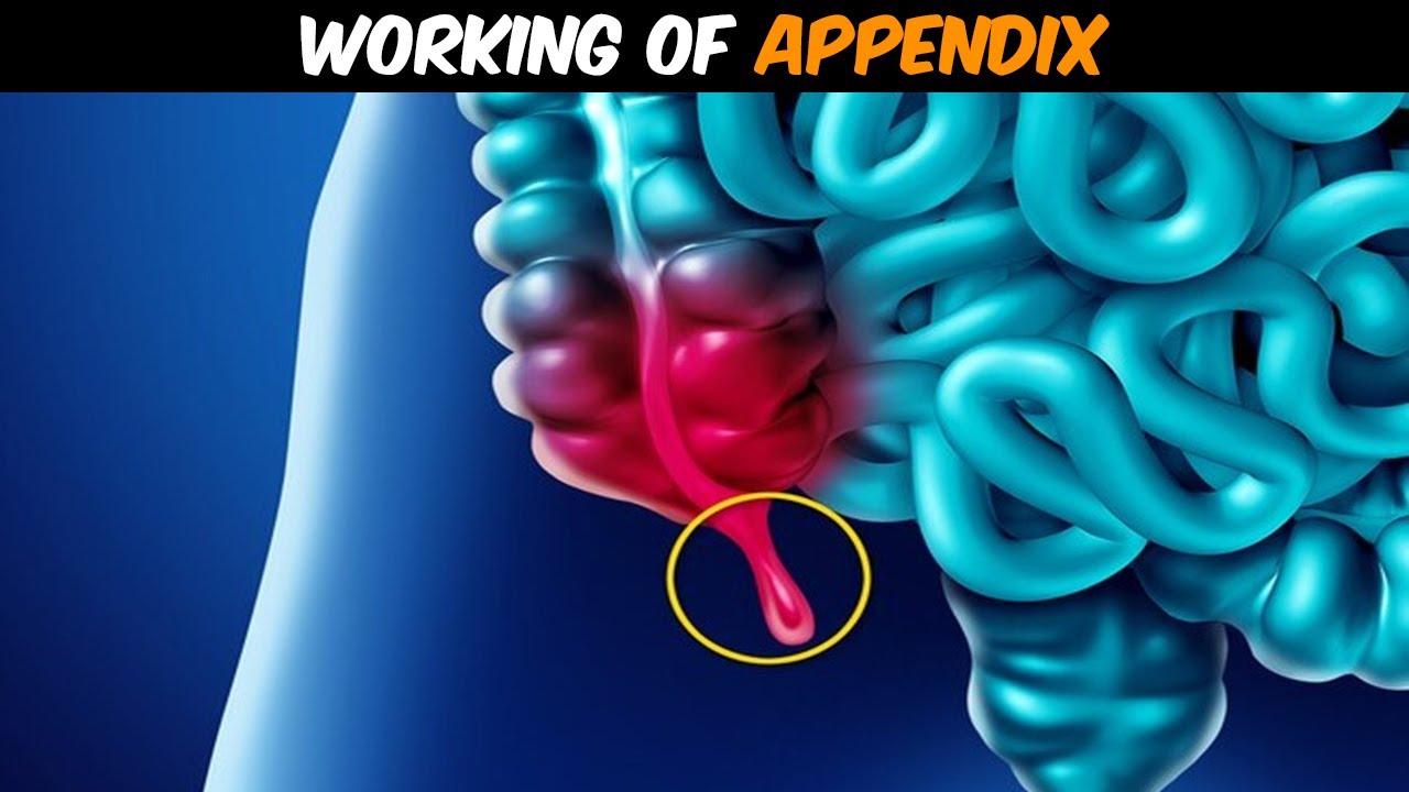 A small appendix can also cause big trouble - YouTube