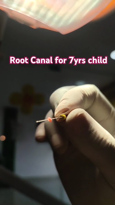 😱 Root canal for 7 yrs child #kidsdentist #bestdentistinhyderabad #trending #hyderabaddentist ...