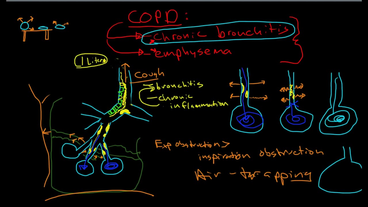 COPD Pathophysiology - YouTube