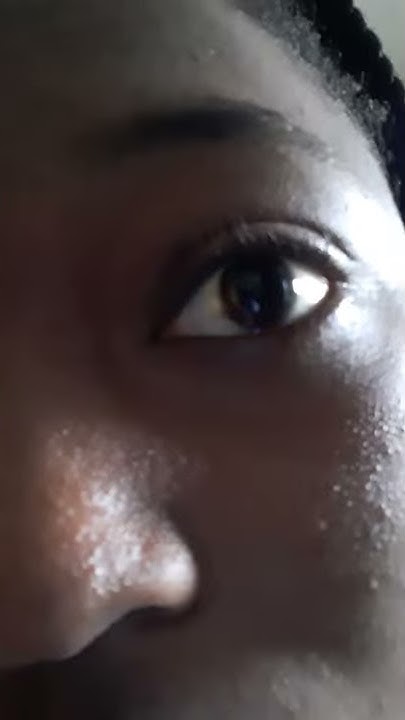 Something in my EYE Part 1 - YouTube