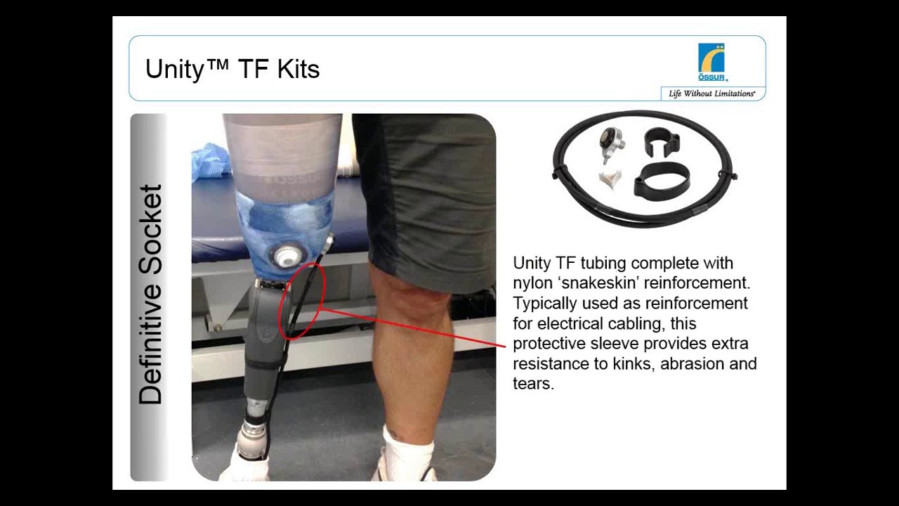 January 2015: Unity Elevated Vacuum System for Transfemoral Amputees ...