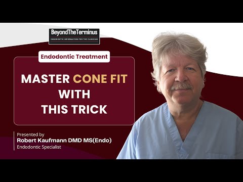 Chloroform Dip Technique: Perfecting Cone Fit in Complex Canals