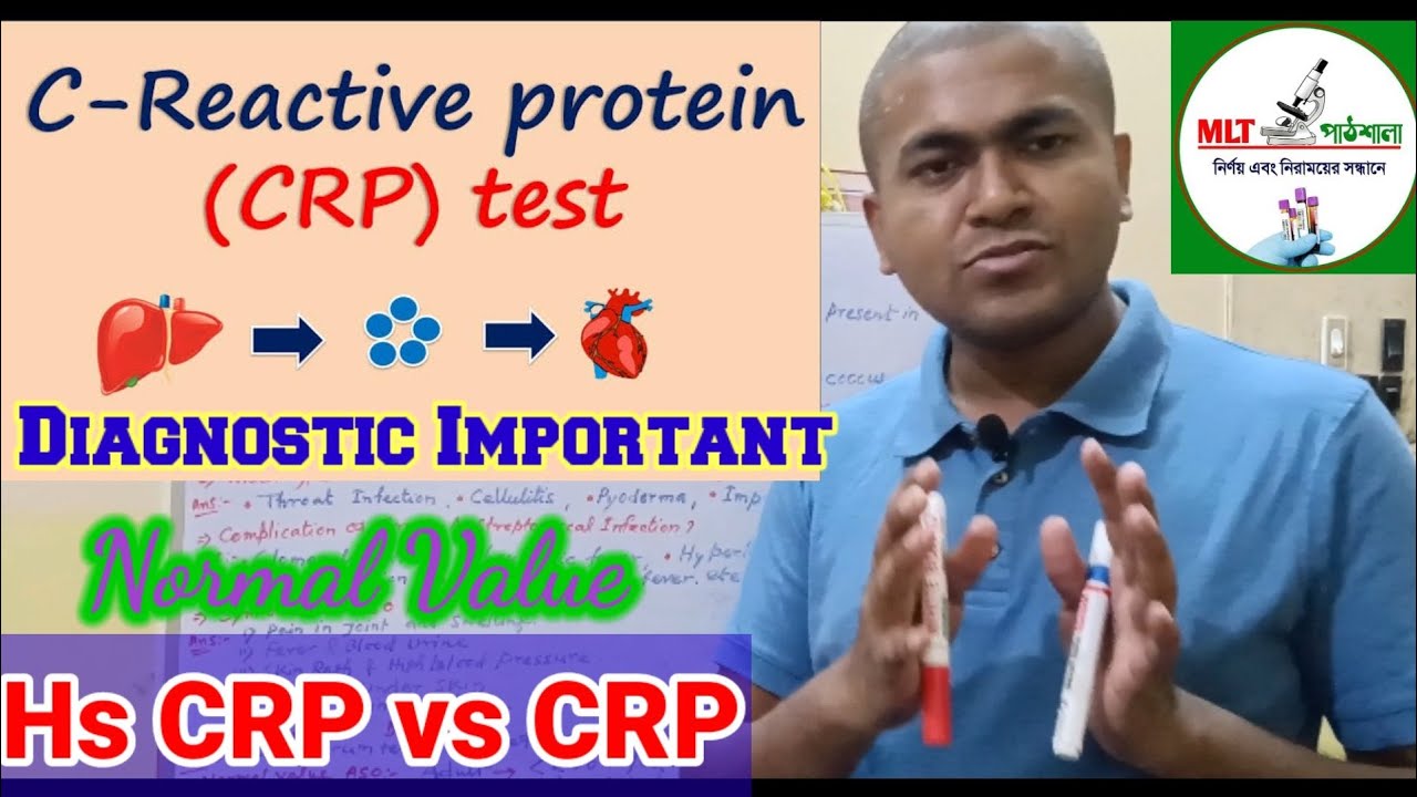 CRP Test Ll C Reactive Protein CRP Blood Test Ll Different Between crp-test-ll-c-reactive-protein-crp-blood-test-ll-different-between
