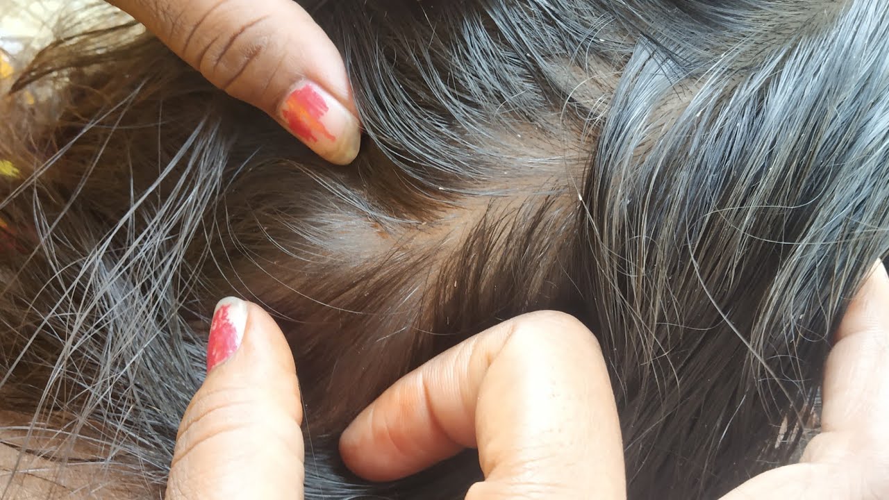 Kanishka nitpicking In Short Hair 07/06/2023 - YouTube