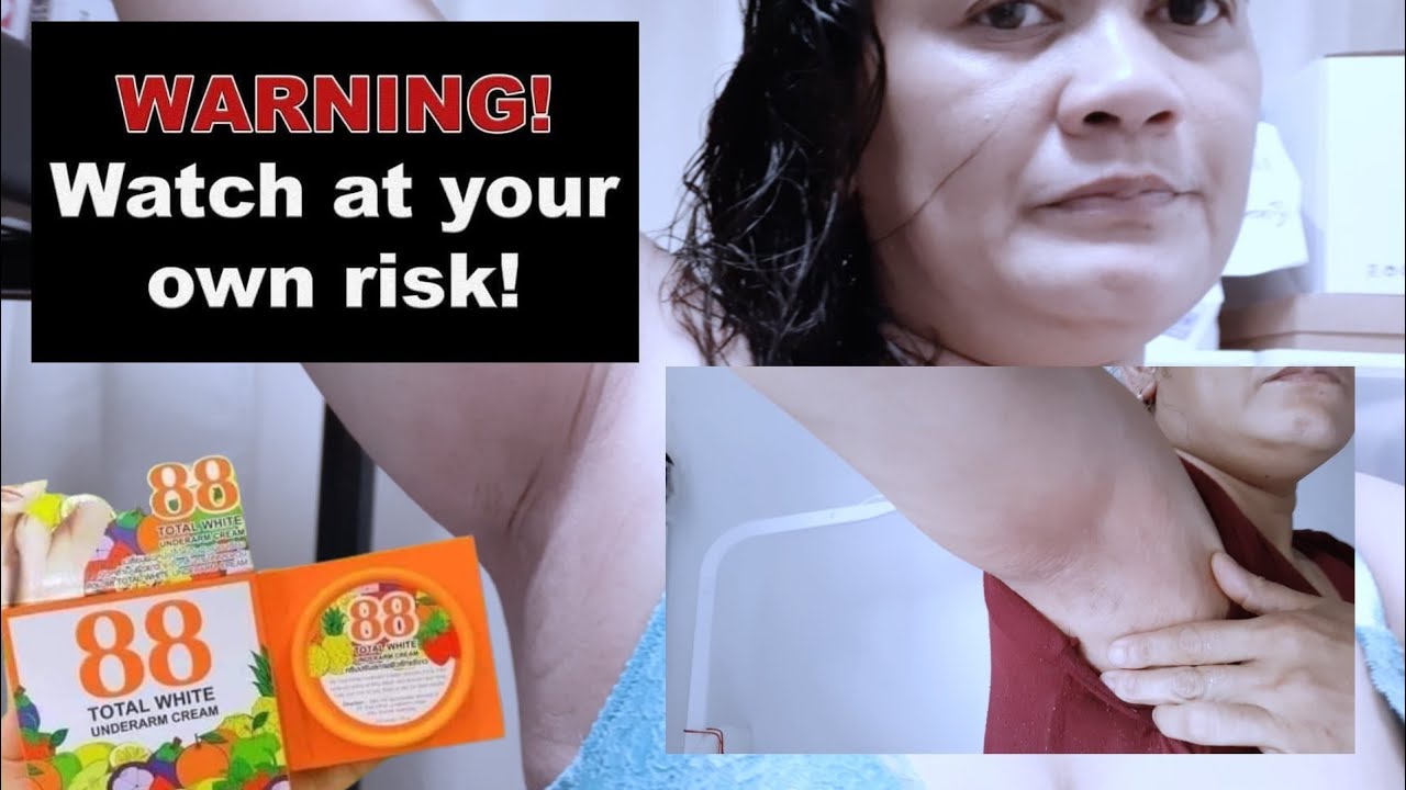 WARNING!!! WATCH THIS BEFORE USING 88 TOTAL WHITE UNDERARM CREAM/BAD ...