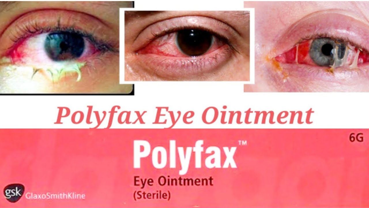 Polyfax eye ointment uses in urdu Hindi - YouTube
