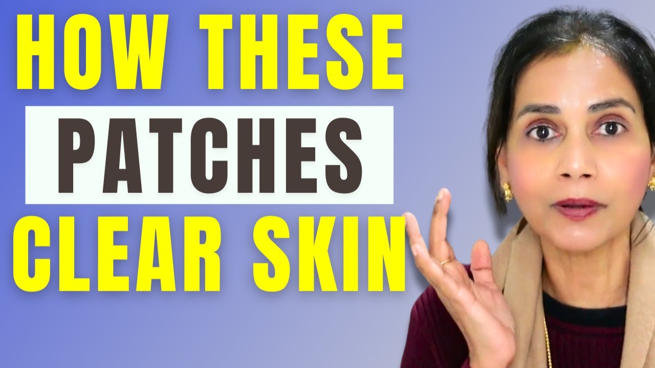 Why These BEST ACNE PATCHES Work? - YouTube