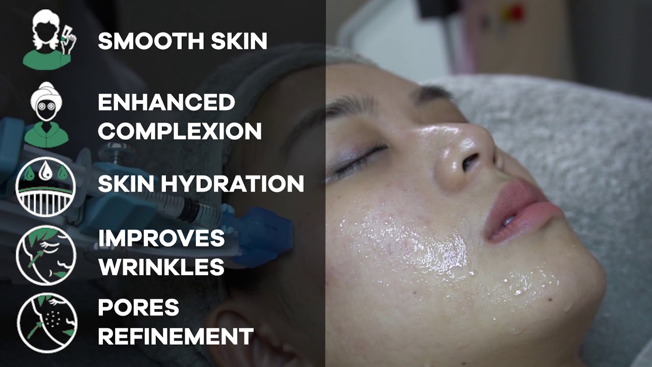 Korean Skin Booster Injection 水光针 Explained Benefits Youtube