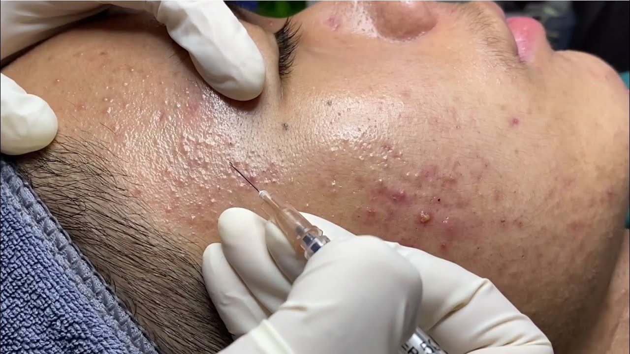 Priority preview content for registered members Spa Linh Mun #5a - YouTube