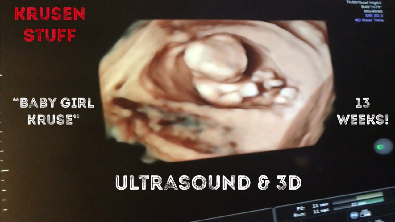 13 Week 3D/Ultrasound Session; “Baby Girl Kruse” Nevaeh Bobbi - YouTube